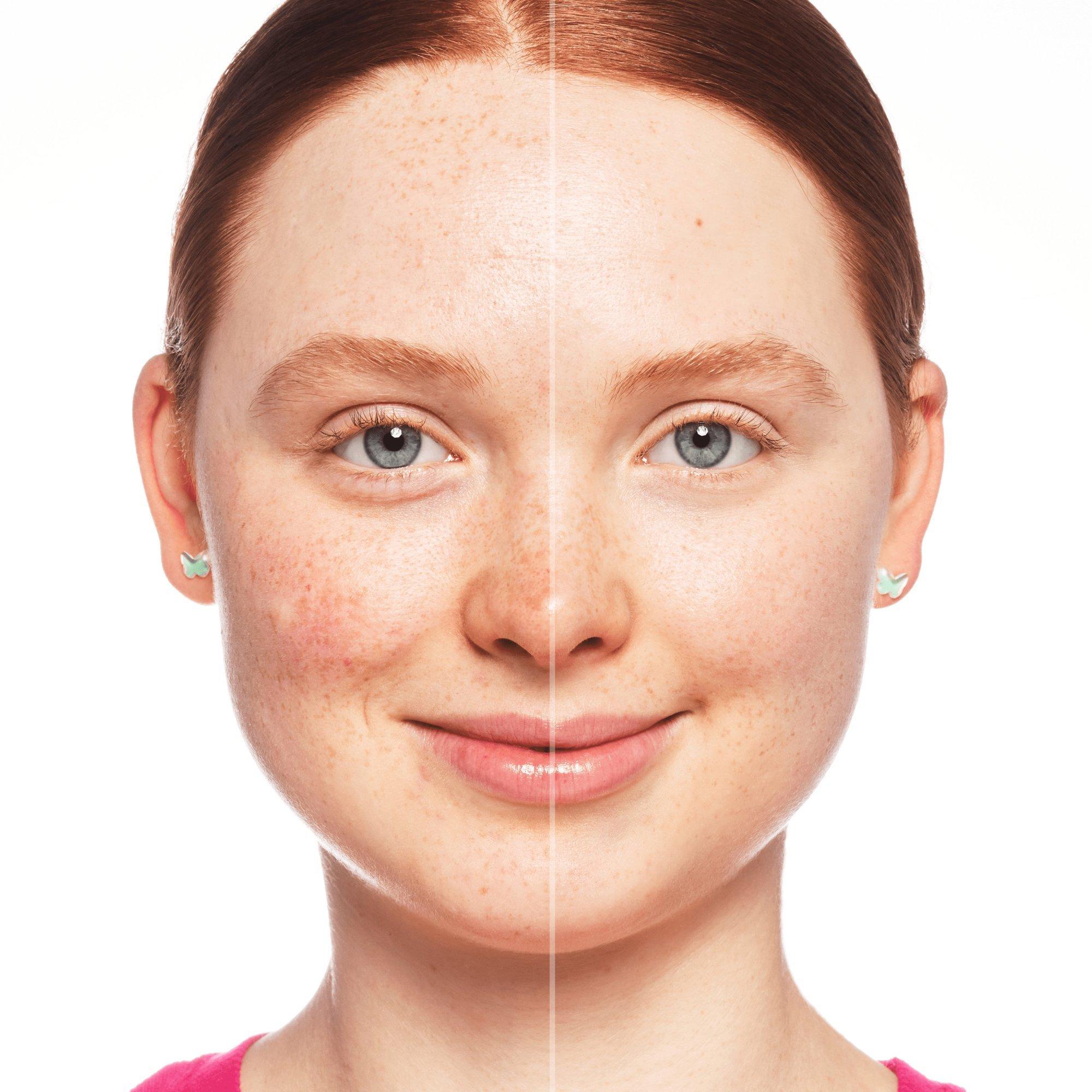 Buy essence CONCEAL like a PRO Colour Correcting Palette online