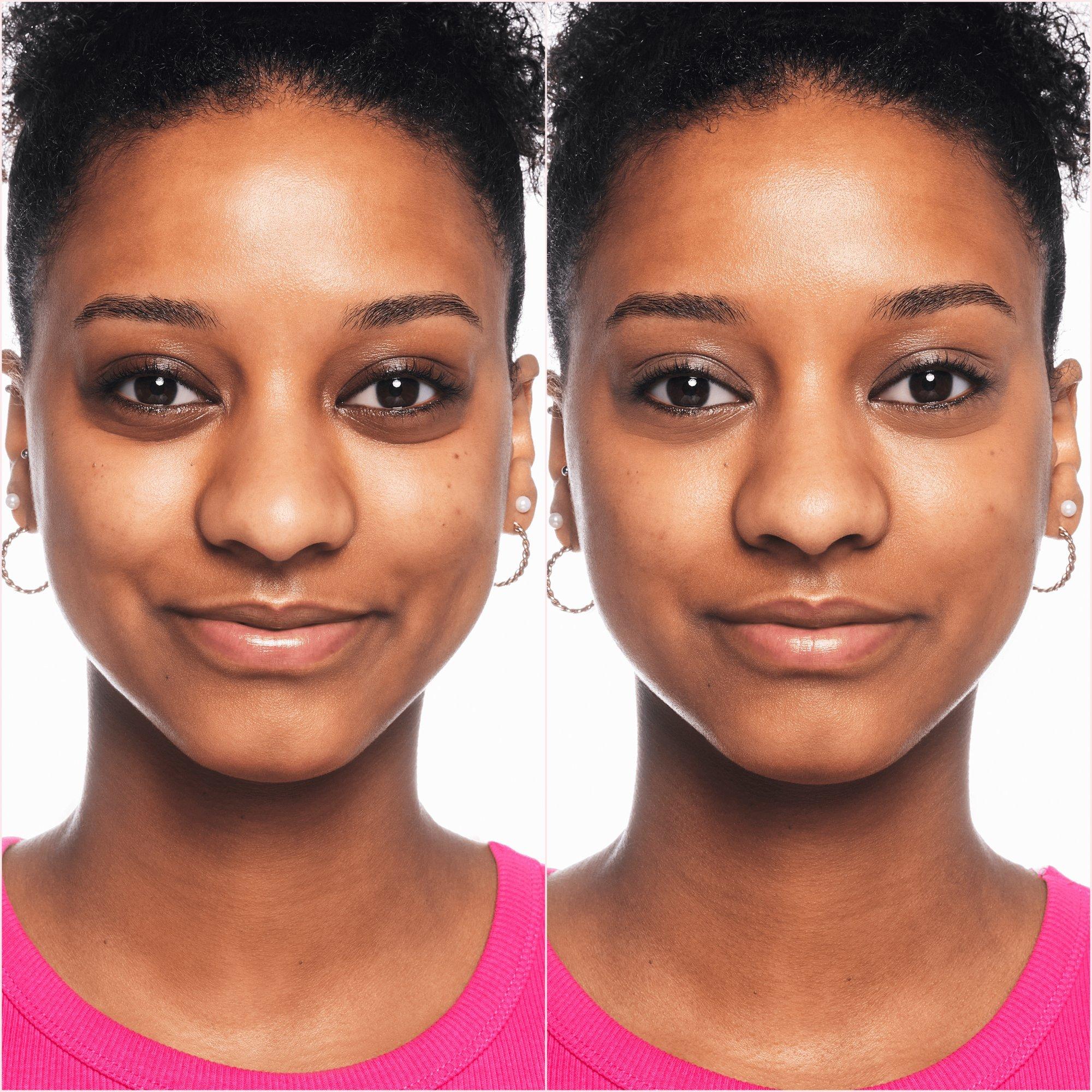 Flawless Skin Before After 8 Women On How They Cleared Their Skin